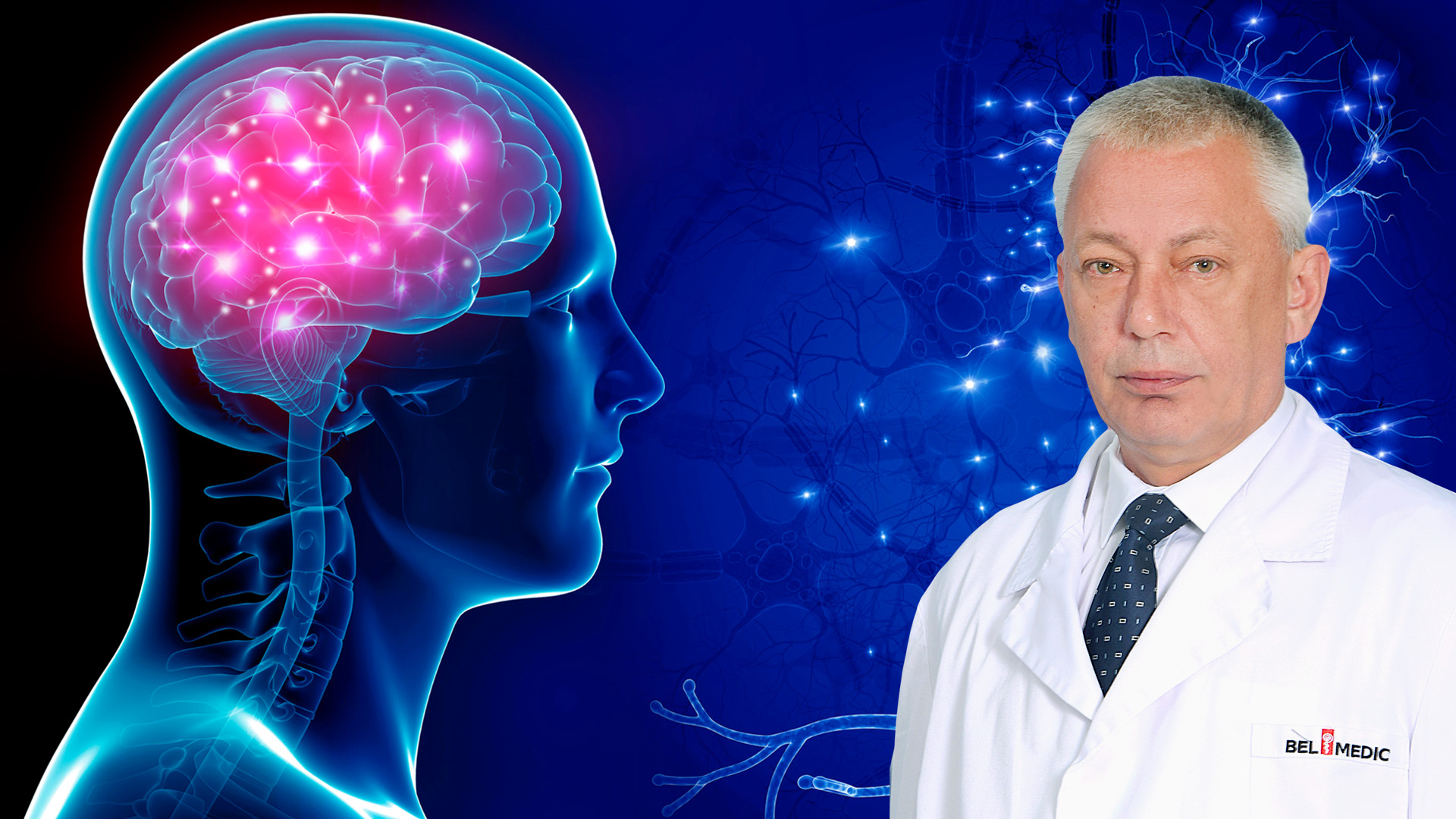 Interventna radiologija u prevenciji i lečenju moždanog udara ...